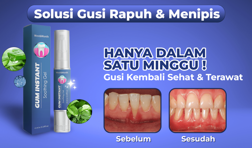 Gum Instant Gel – Solusi Pedia